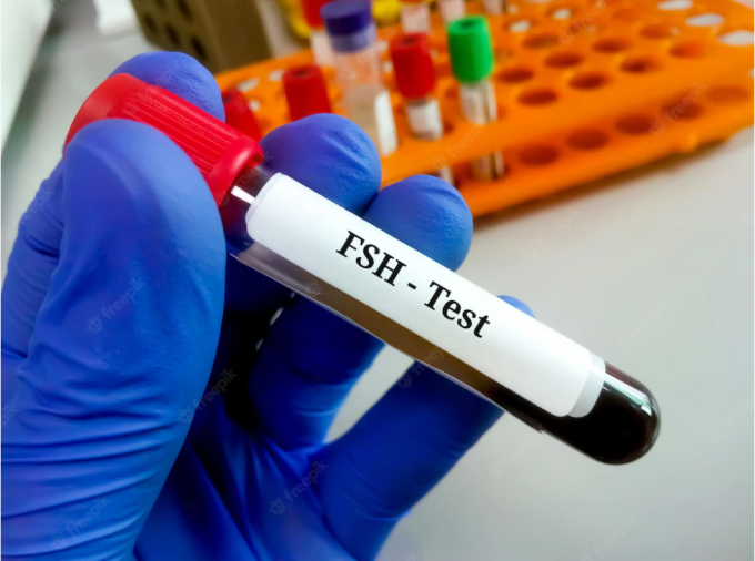 Follicle Stimulating Hormone FSH Rapid Test 2T 40T 50T Women's Health ...