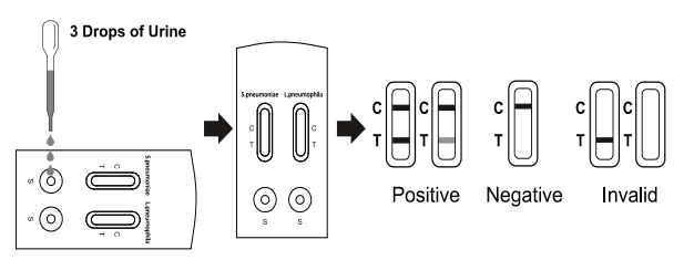 Streptococcus Pneumoniae Legionella Pneumophila Test Infectious Disease ...