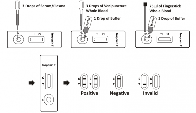 CTnT Cardiac Troponin T Rapid Test Chromatographic Immunoassay WB S P