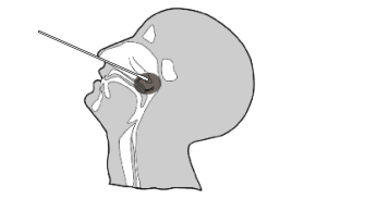 SARS-CoV-2 Influenza A+B RSV Antigen Combo Rapid Test Nasopharyngeal Swab