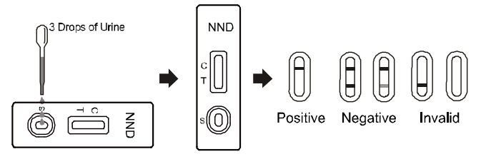 N, N-Dimethyltryptamine Rapid Test Cassette 1000 Ng/ML Urine Specimen